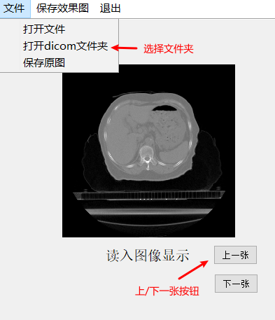 matlab实现多个dicom文件读取_matlab 存dcm-CSDN博客