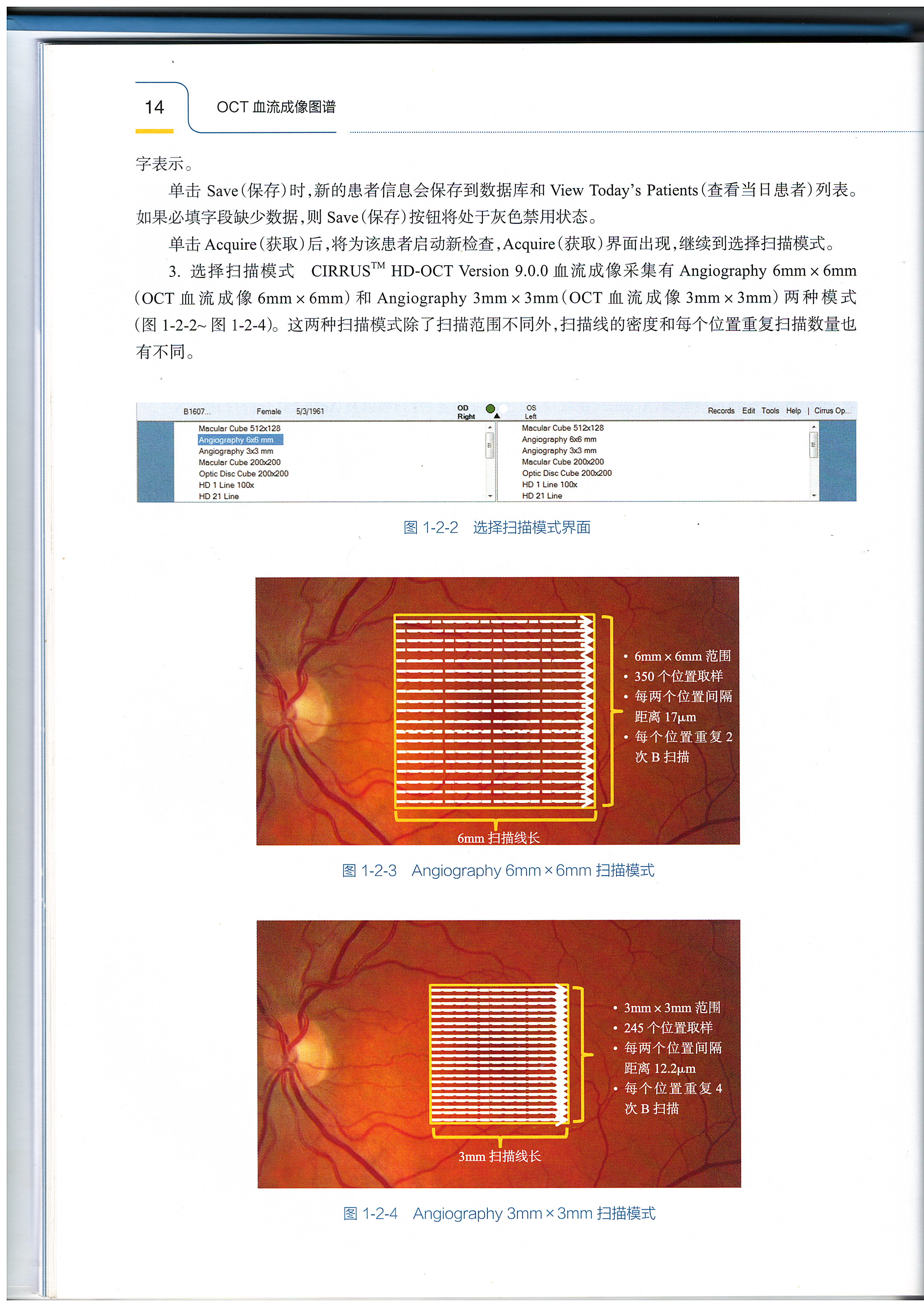 【医学图像处理】关于OCT（Optical Coherence Tomography ）的介绍_oct图像-CSDN博客