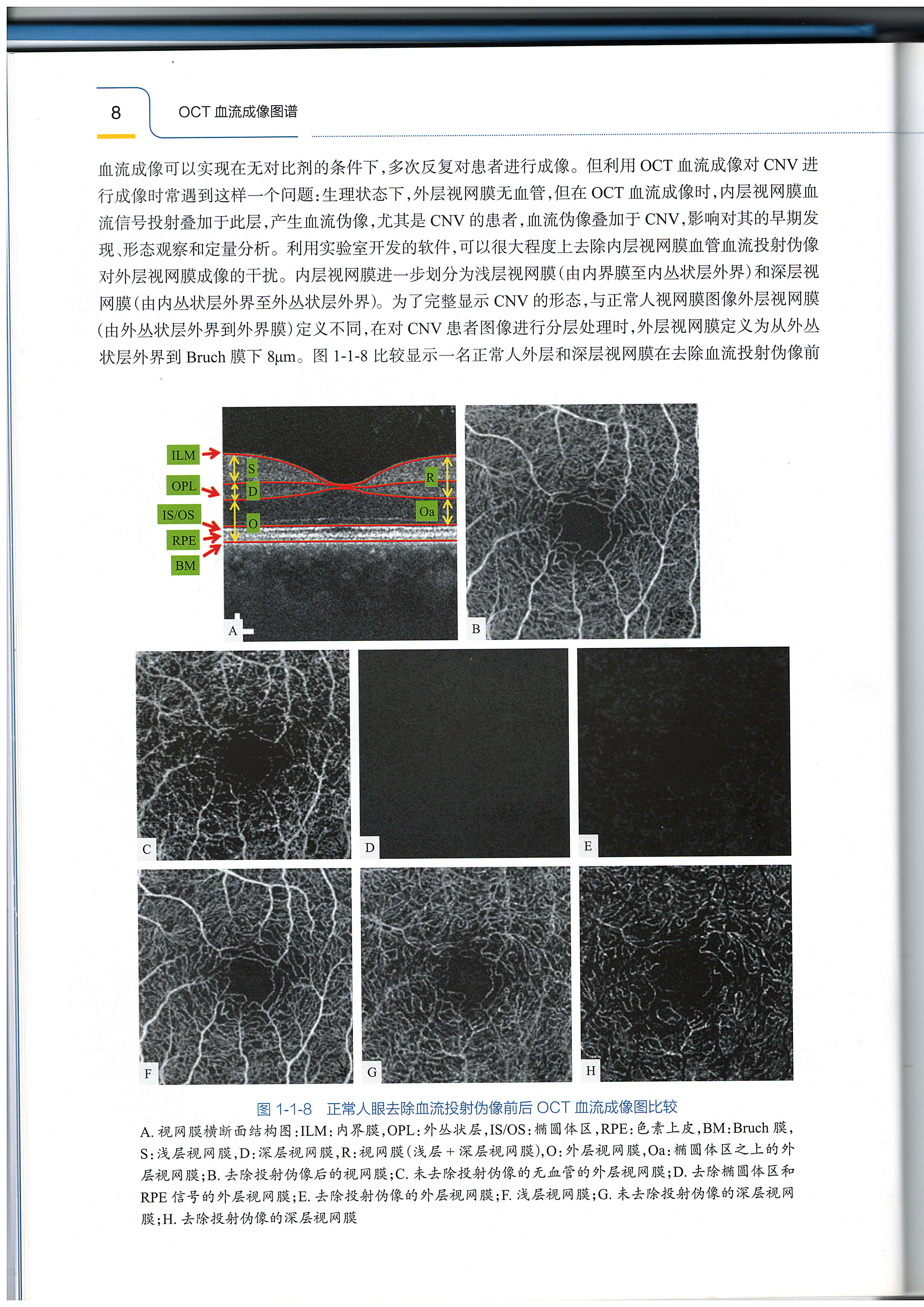 【医学图像处理】关于OCT（Optical Coherence Tomography ）的介绍_oct图像-CSDN博客
