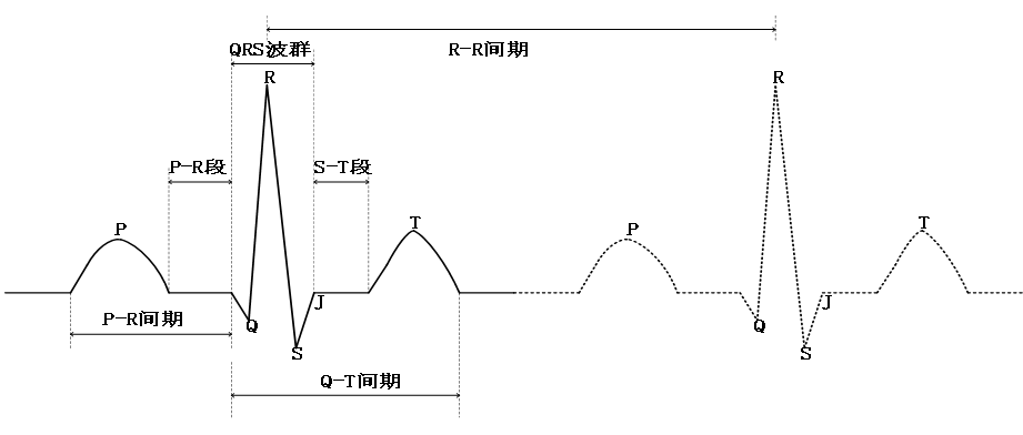 基于深度学习心电图（ecg）特征识别ecg识别竞赛 Csdn博客 