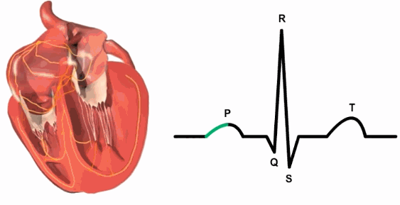 基于深度学习心电图（ECG）特征识别_ecg识别竞赛-CSDN博客