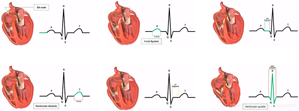 基于深度学习心电图（ECG）特征识别_ecg识别竞赛-CSDN博客