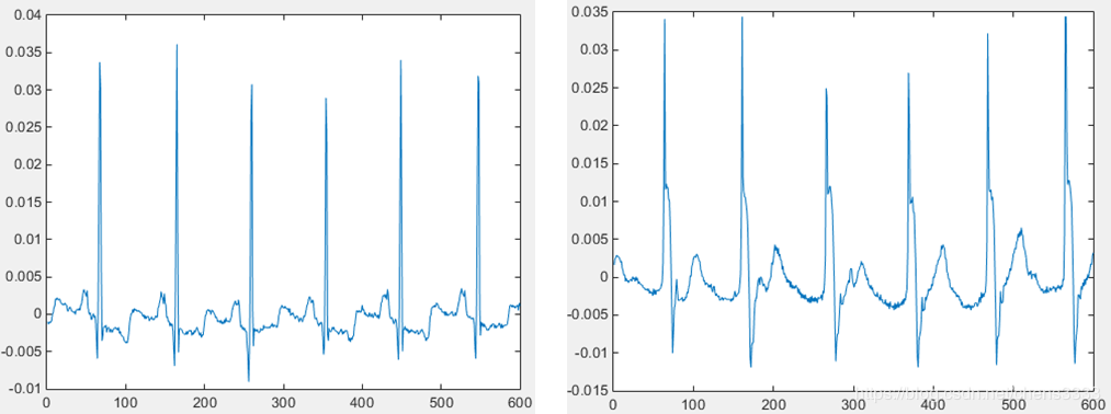 基于深度学习心电图（ECG）特征识别_ecg识别竞赛-CSDN博客