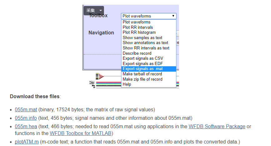 MIMIC数据库中数据的下载以及MATLAB读取_mimic数据库怎么在matlab中使用-CSDN博客