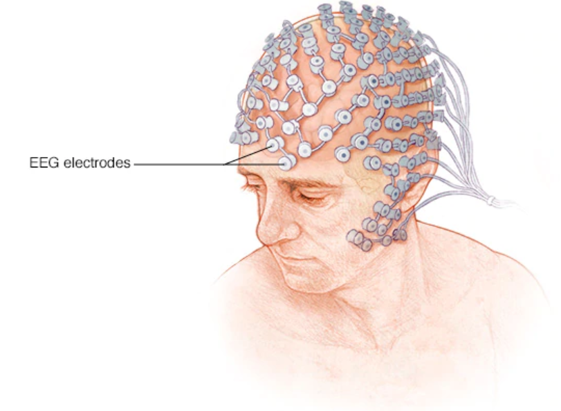 EEG市场调研_g.tec eeg-CSDN博客