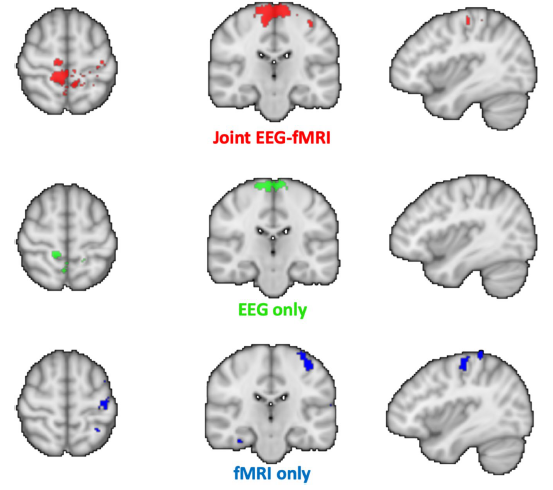 在神经反馈任务中同时进行EEG-fMRI，多模态数据集成的大脑成像数据集_fmri 和eeg数据分析计算步骤-CSDN博客