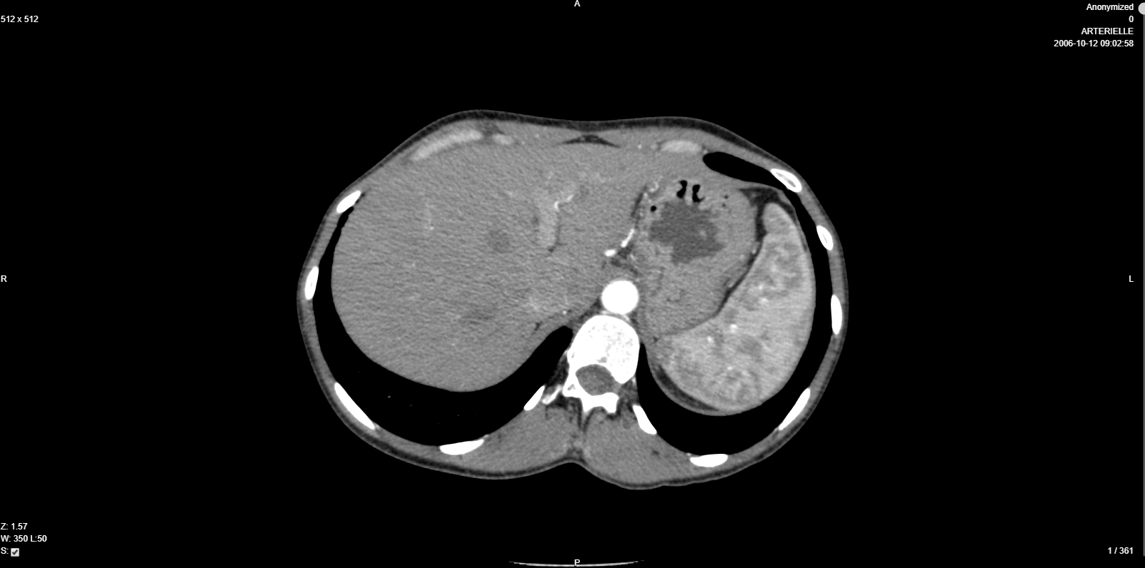dcm (dicom) medical imaging android through dcmtk analysis - Programmer ...