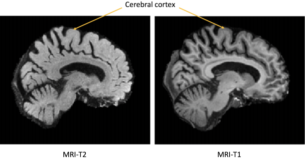 Multi-Modal Image Registration with Unsupervised Deep Learning-CSDN博客