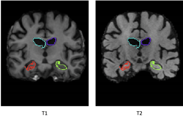 Multi-Modal Image Registration with Unsupervised Deep Learning-CSDN博客