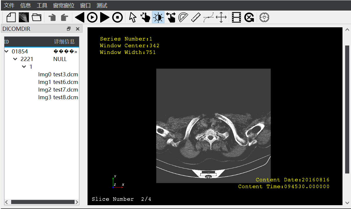 VS+VTK+Dicom(dcm)+CT影像切片窗体界面显示源码_vtk dicom切片-CSDN博客