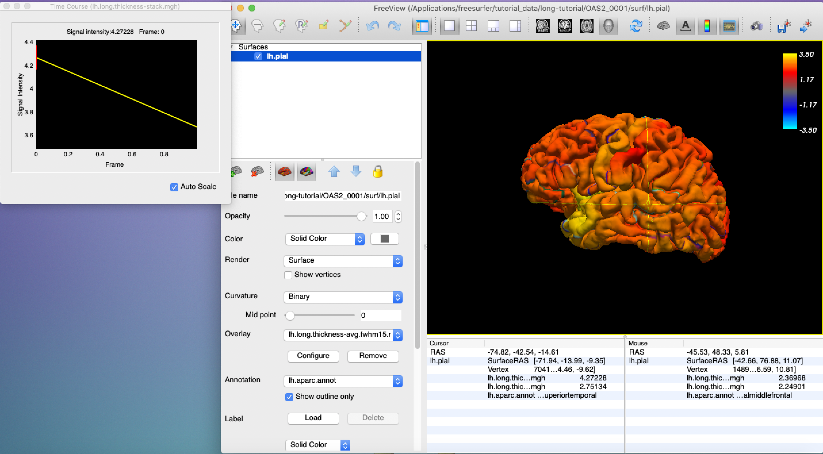 Freesurfer学习笔记——Longitudinal Tutorial 9/13_freesurfer 纵向数据-CSDN博客