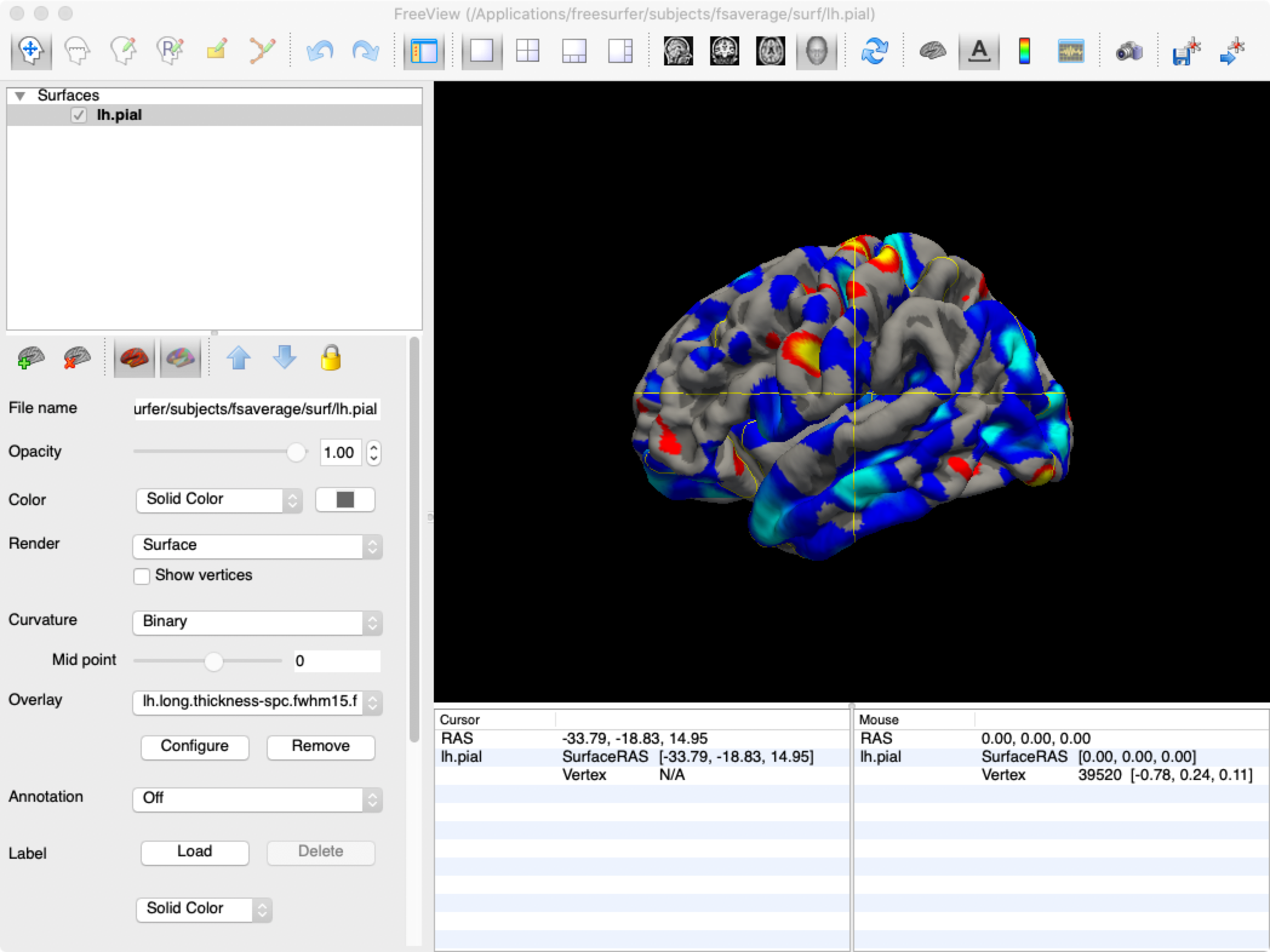 Freesurfer学习笔记——Longitudinal Tutorial 9/13_freesurfer 纵向数据-CSDN博客