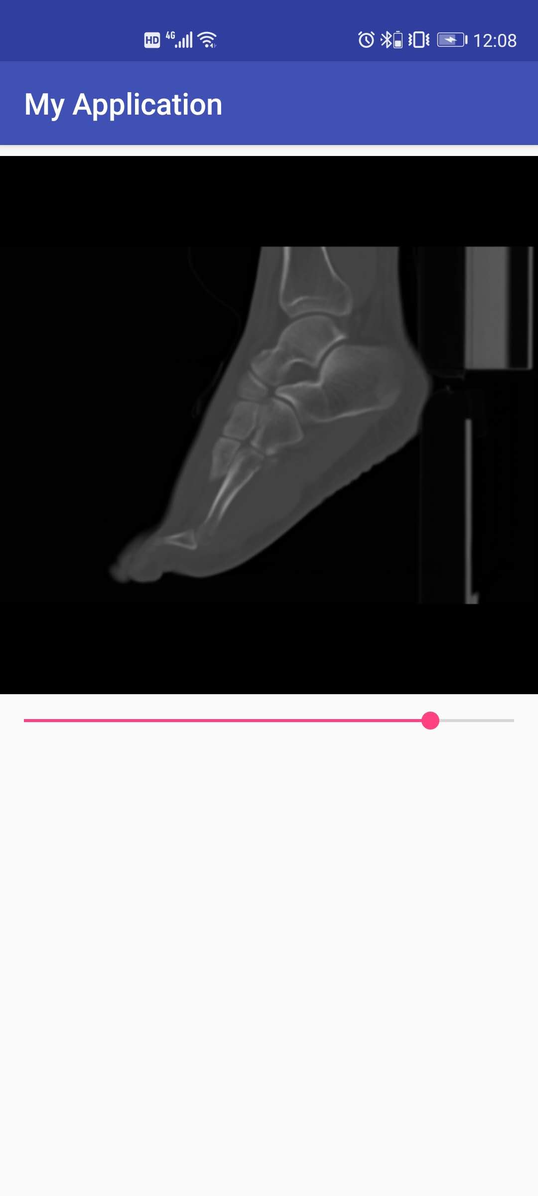 dcm(dicom)医学影像android通过dcmtk解析_android dcmtk-CSDN博客