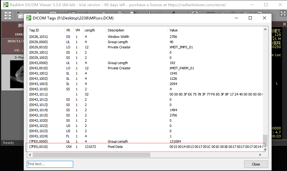 使用dcm4che对压缩的dcm文件进行解压_压缩的dicom文件如何解压-CSDN博客