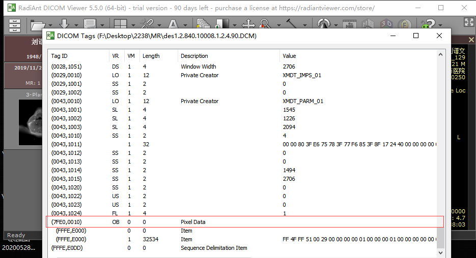 使用dcm4che对压缩的dcm文件进行解压_压缩的dicom文件如何解压-CSDN博客