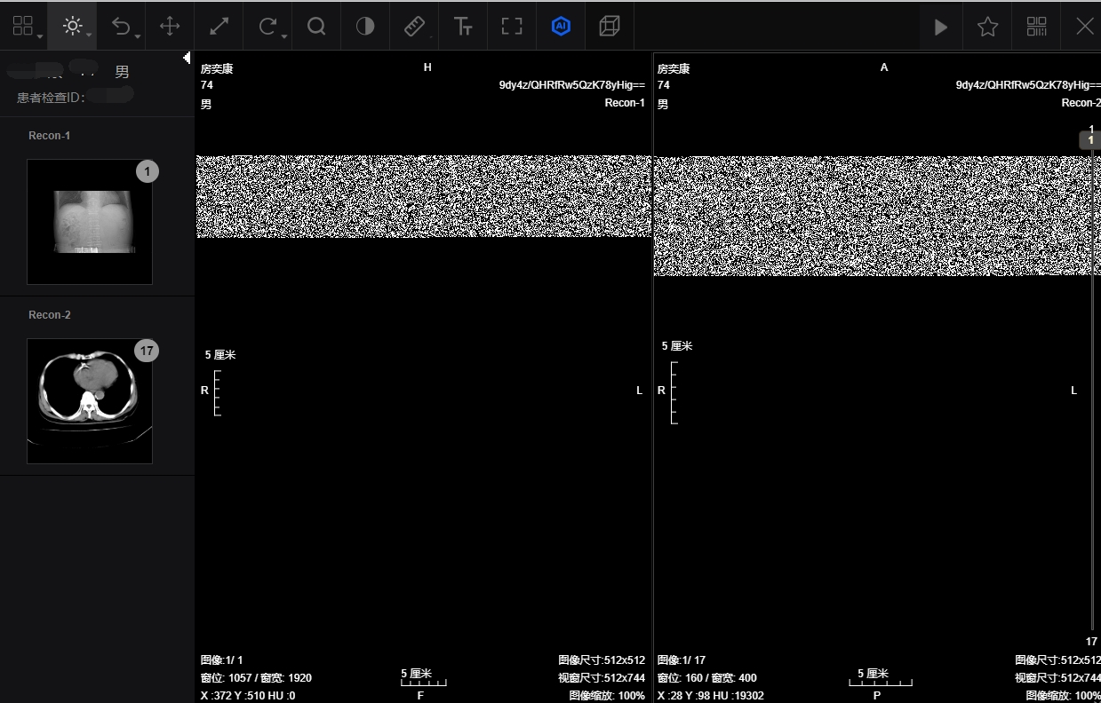 使用dcm4che对压缩的dcm文件进行解压_压缩的dicom文件如何解压-CSDN博客