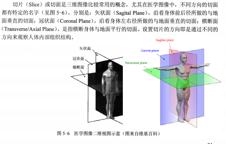 VTK图形图像开发进阶-学习笔记 05(01) VTK图像处理-CSDN博客