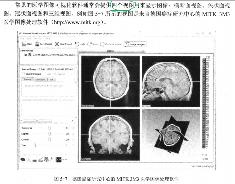 VTK图形图像开发进阶-学习笔记 05(01) VTK图像处理-CSDN博客