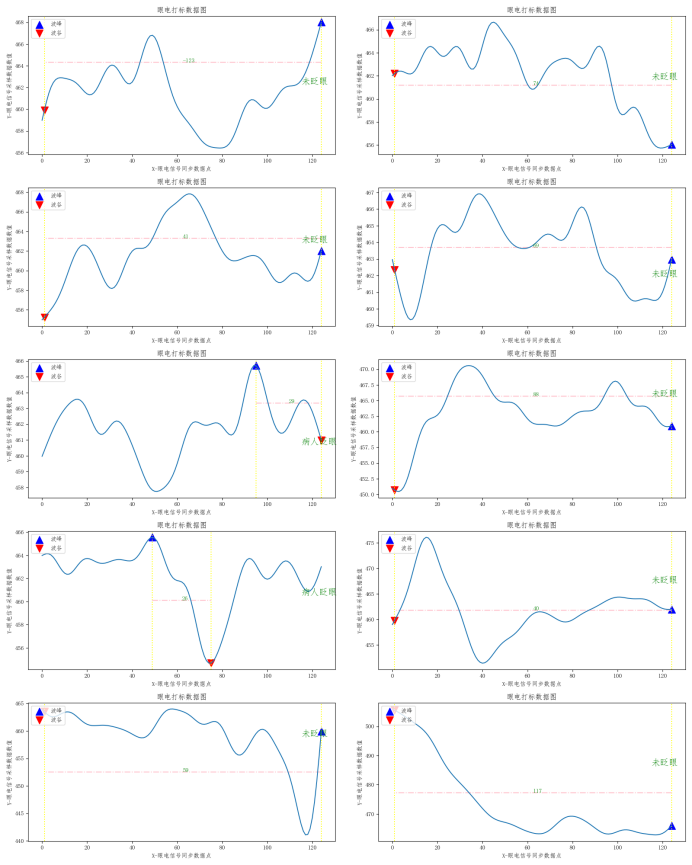 EOG眼电信号（眨眼检测）-CSDN博客