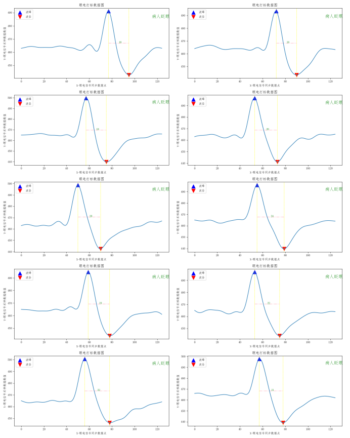 EOG眼电信号（眨眼检测）-CSDN博客