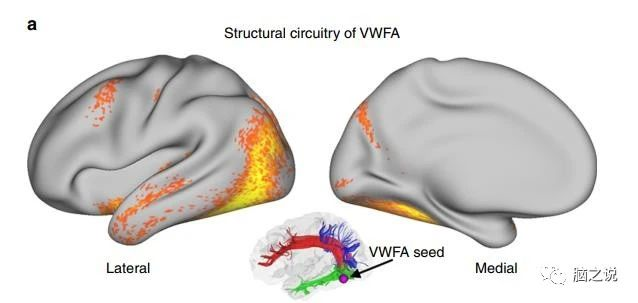 Nature communications：VWFA，一个集语言与注意于一身的脑区_vwfa脑区-CSDN博客