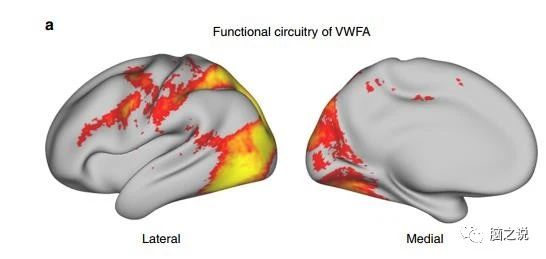 Nature communications：VWFA，一个集语言与注意于一身的脑区_vwfa脑区-CSDN博客