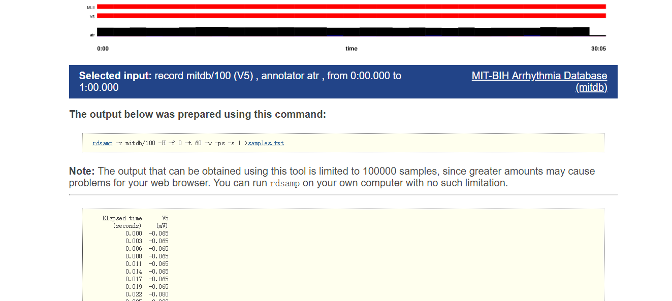 心电信号数据获取txt（matlab)_原心电信号数据怎么用txt格式-CSDN博客