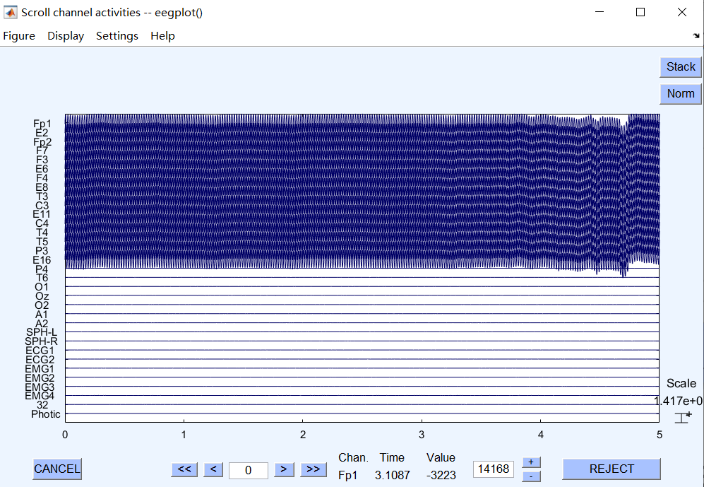 EEGLAB安装、EDF数据导入、EEG预处理（Matlab）_eeglab导入edf-CSDN博客
