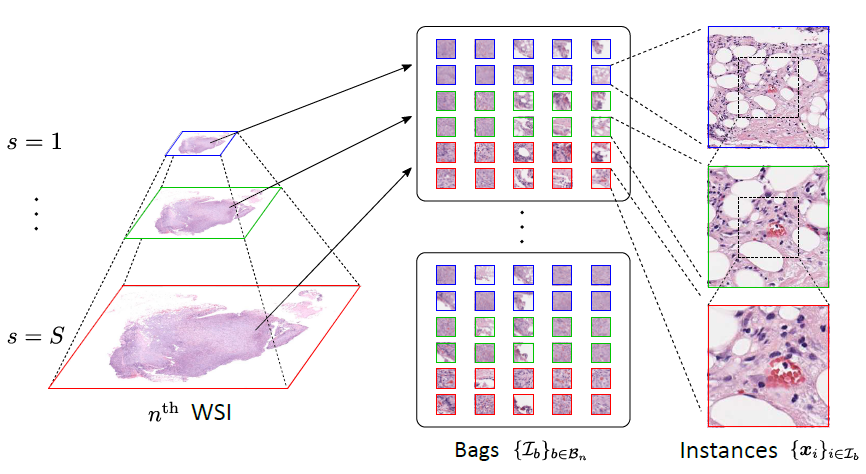 【论文笔记】CVPR2020 Multi-scale Domain-adversarial Multiple-instance CNN for Cancer Subtype ...