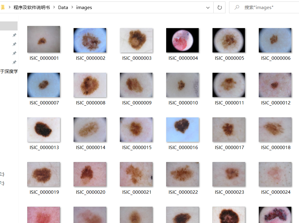 ISIC数据集下载（问题解决）-CSDN博客
