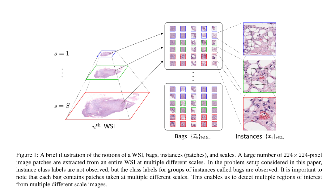 论文阅读——Multi-scale Domain-adversarial Multiple-instance CNN for Cancer Subtype Classification-CSDN博客