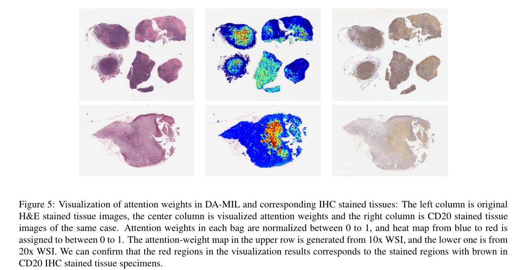 论文阅读——Multi-scale Domain-adversarial Multiple-instance CNN for Cancer Subtype Classification-CSDN博客