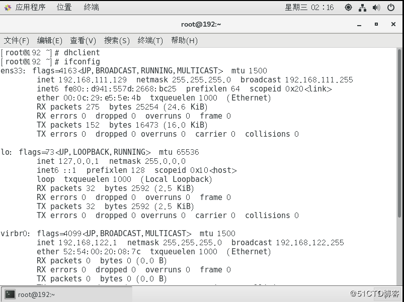 改ip后无法连xshell问题_linux更改了ip为什么xshell登不上-CSDN博客
