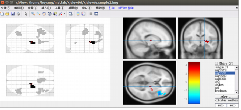 用xjview可视化fMRI分析结果-CSDN博客