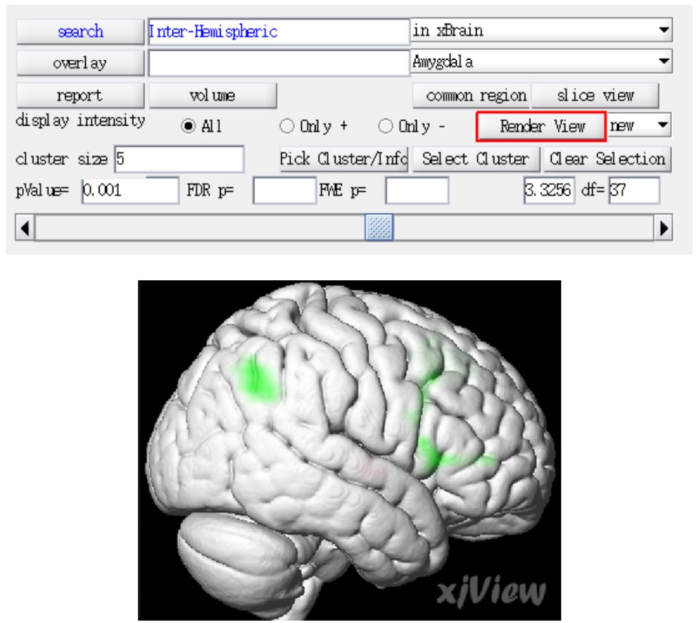 用xjview可视化fMRI分析结果-CSDN博客