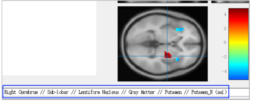 用xjview可视化fMRI分析结果-CSDN博客