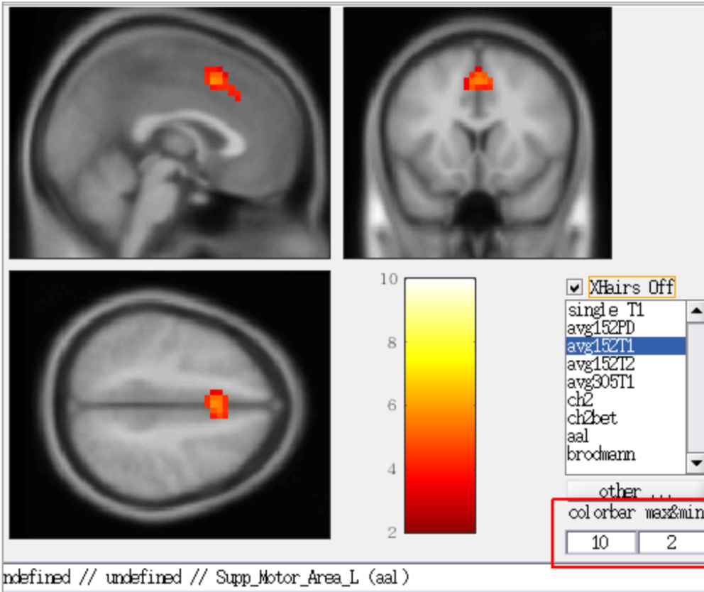 用xjview可视化fMRI分析结果-CSDN博客