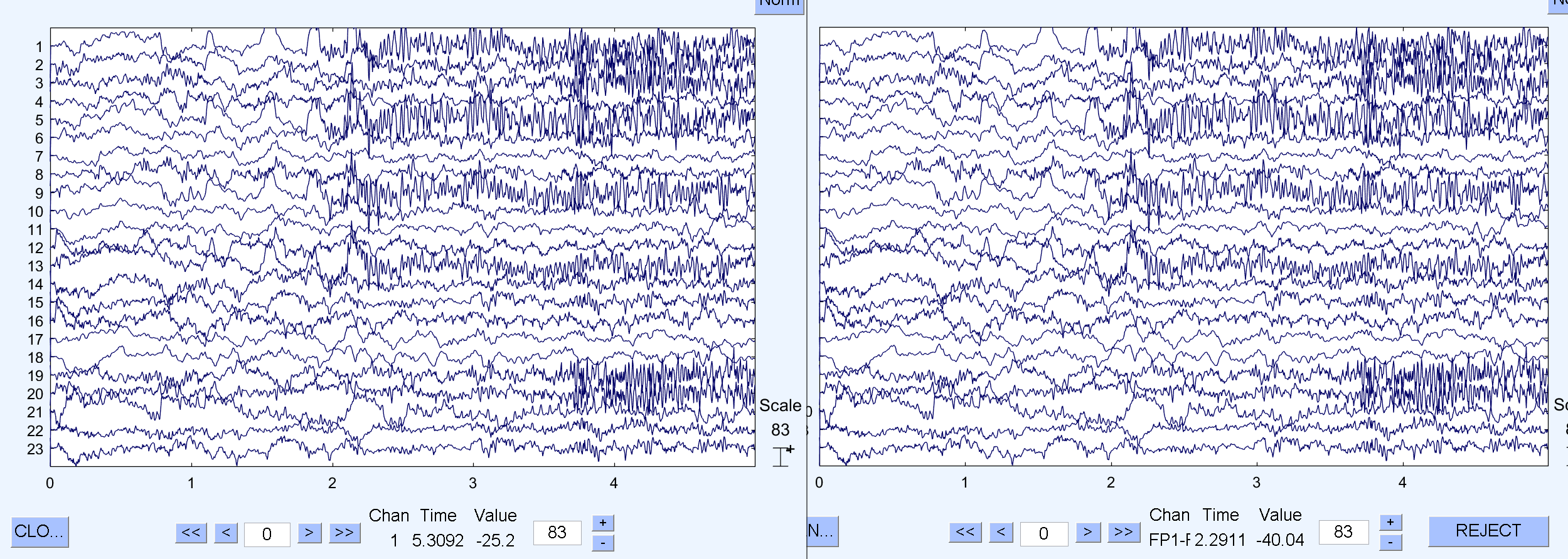 Matlab Edf文件转mat文件代码mat转edf Csdn博客 