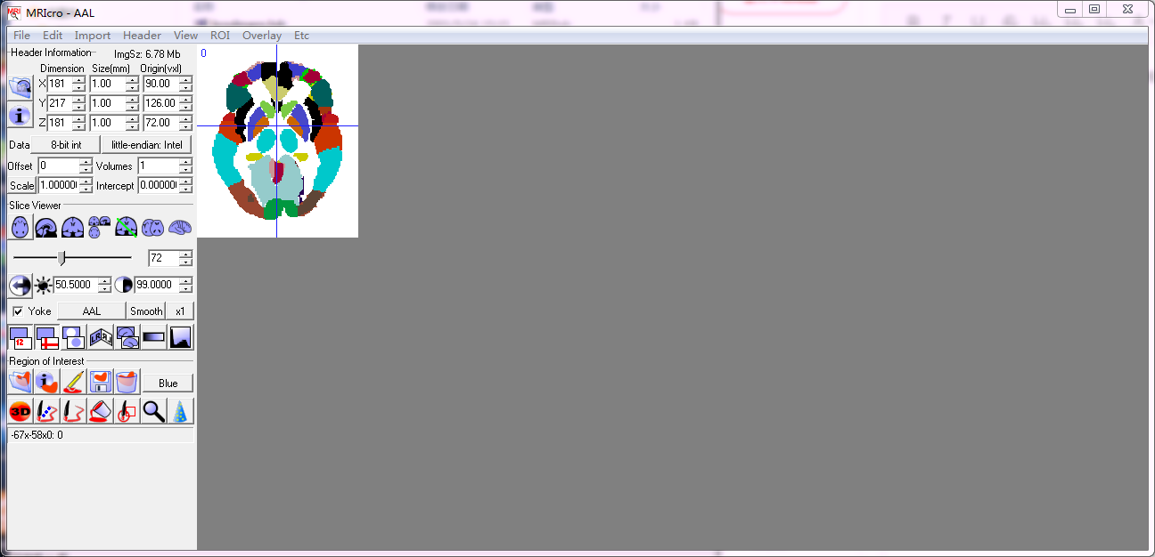 MRIcron使用-CSDN博客