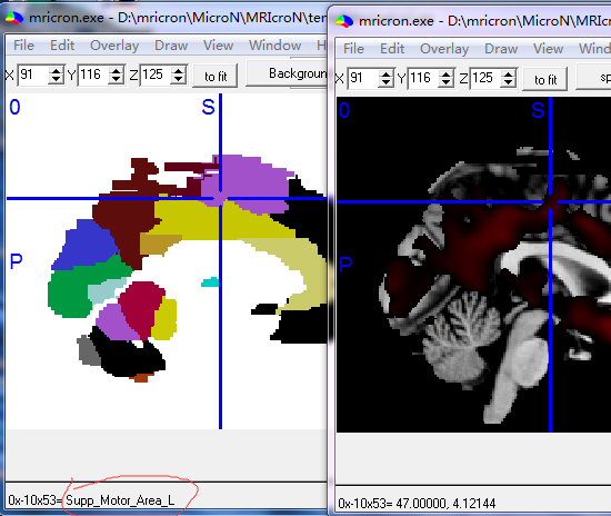 MRIcron使用-CSDN博客