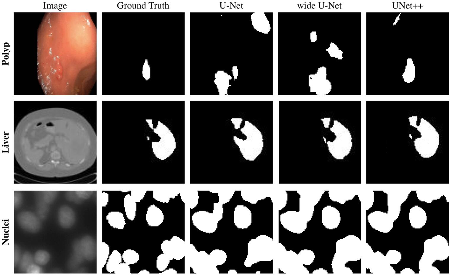 【论文笔记】UNet++：一种用于医学图像分割的嵌套U-Net结构_unet跳跃连接的作用-CSDN博客