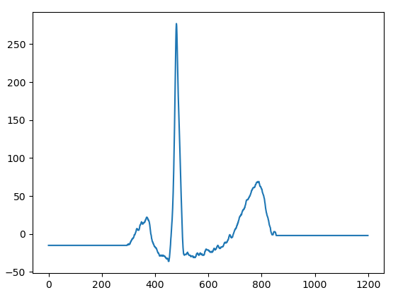 ECG心电数据文件.xml读取_心电数据xml-CSDN博客