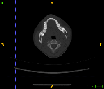 2D-X光图像重建3D-CT图像项目总结_医学图像2d序列生成3d模型-CSDN博客