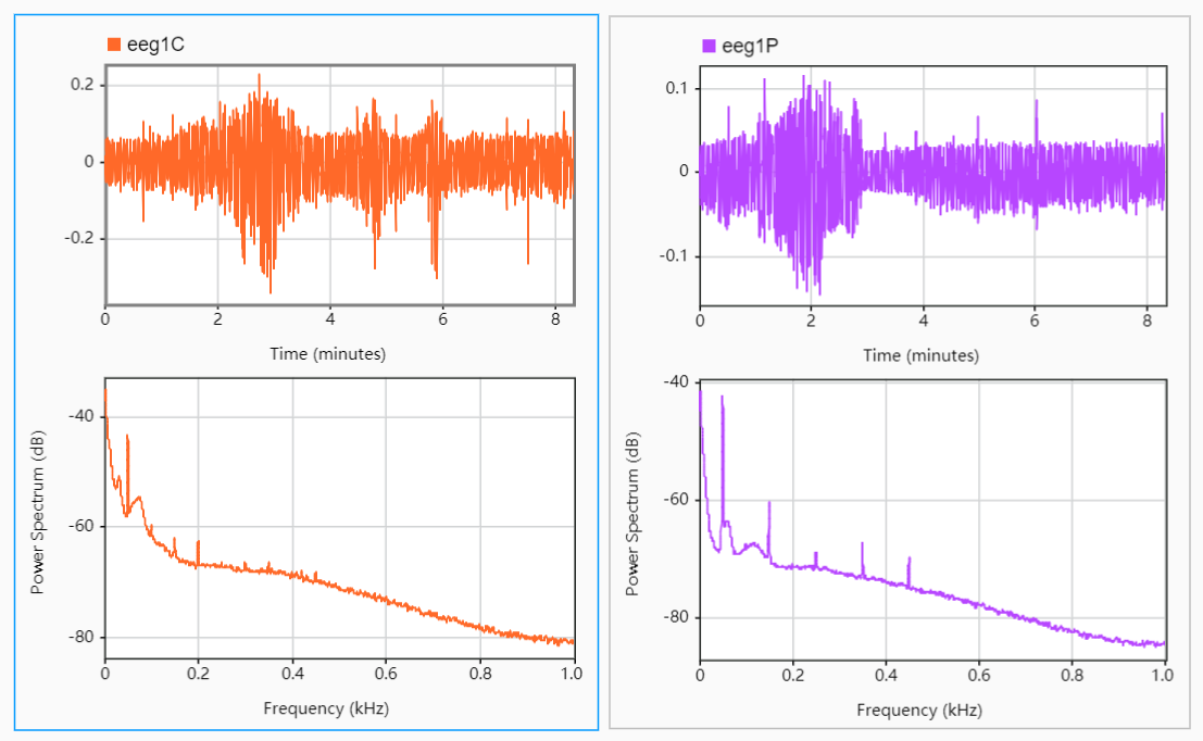Understanding of LFP and EEG_lfp信号-CSDN博客
