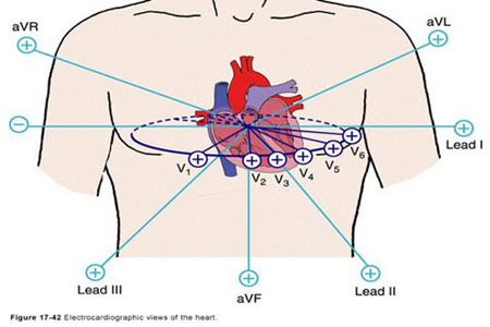 ECG信号_ecg波形特点-CSDN博客