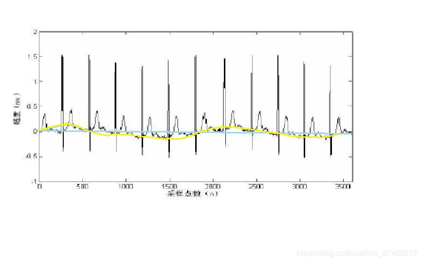 ECG信号_ecg波形特点-CSDN博客