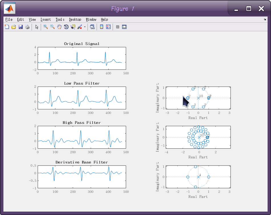 心电信号的PQRST模拟matlab代码(转载+自己调研汇总)-CSDN博客
