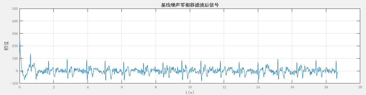 心电信号的PQRST模拟matlab代码(转载+自己调研汇总)-CSDN博客