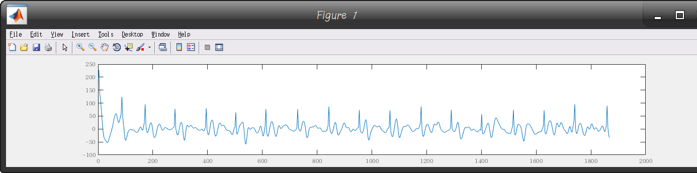 Matlab心电信号的PQRST模拟-实验报告_心电信号处理实验报告-CSDN博客