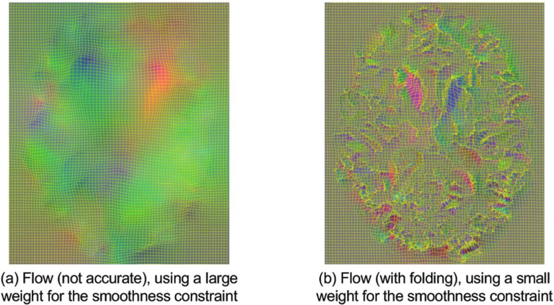 【论文笔记】ICNet：用于无监督医学图像配准的逆一致性模型_inverse-consistent deep networks for unsupervised -CSDN博客
